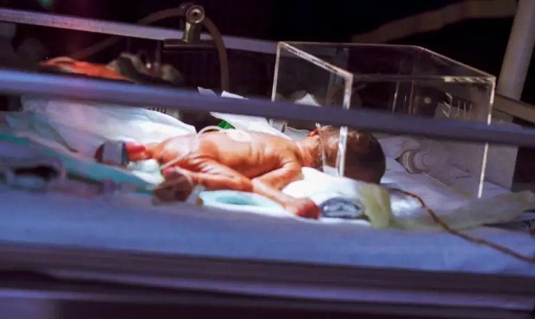 Treatment Options and Outlook for Patau Syndrome: What You Should Know